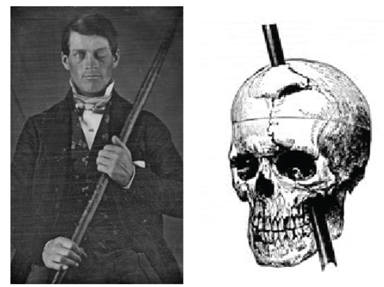 Brain Structure & Function – BioLogically